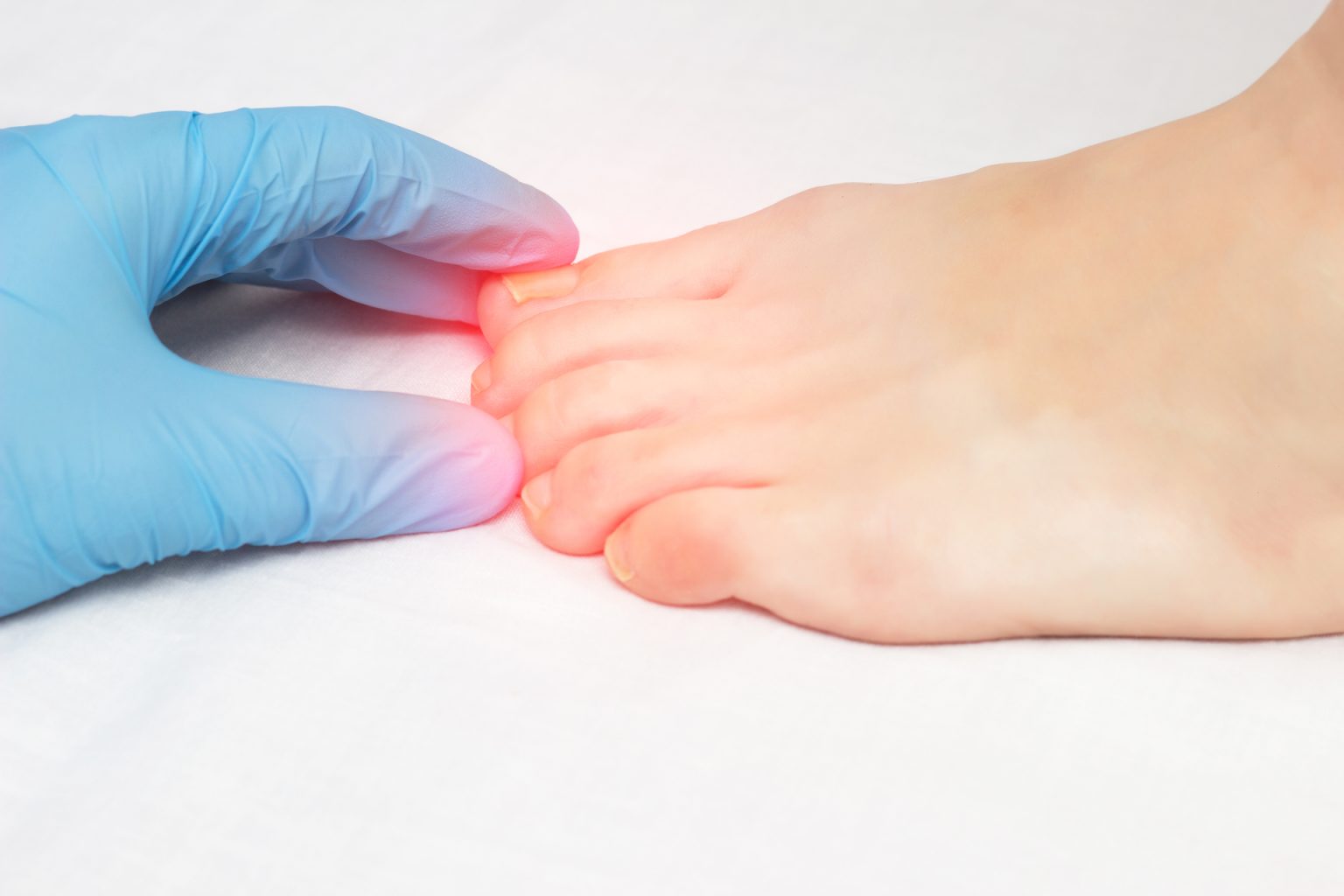 Why a Small Foot Cut Is Dangerous for Diabetics | Diabetic Foot Care Tips
